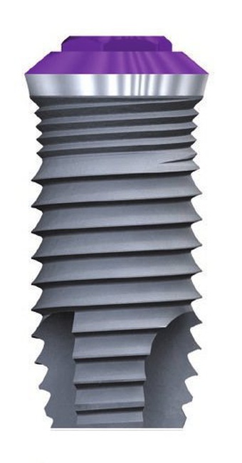 Phibo TSA Implante dentário | SpotImplant