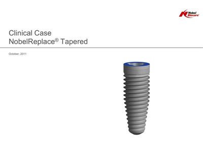 Nobel Biocare NobelReplace Tapered Dental Implant | SpotImplant