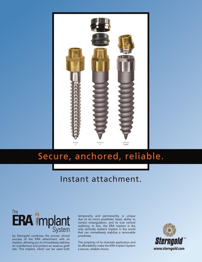 Sterngold Dental Implants | SpotImplant