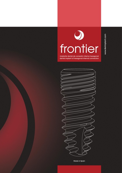 GMI (Global Medical Implants) Frontier Dental Implant | SpotImplant