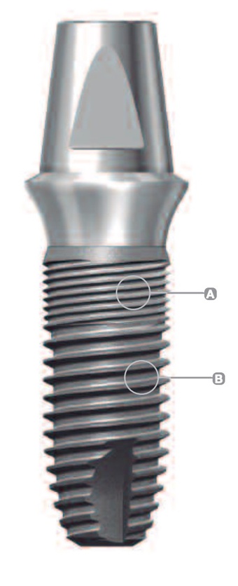 Dentium SlimLine Dental Implant | SpotImplant