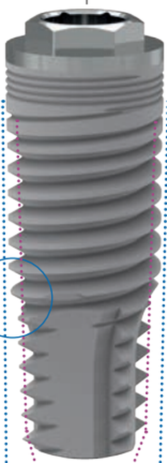 Ziacom / Osseolife Galaxy Dental Implant | SpotImplant