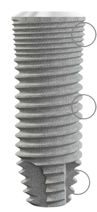 FMD Dental Implants | SpotImplant