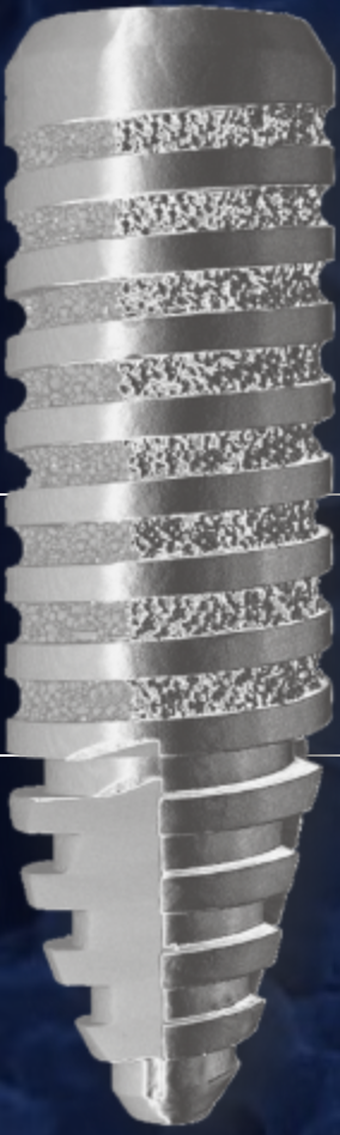 Open Cell Biomedical Dental Implants | SpotImplant