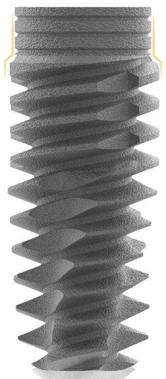 Alfa Gate Dental Implants | SpotImplant