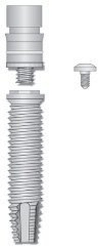 Serson Implant Implantes dentários | SpotImplant