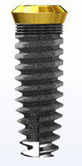 OCO Biomedical Engage (Bone Level Implant) Dental Implant | SpotImplant