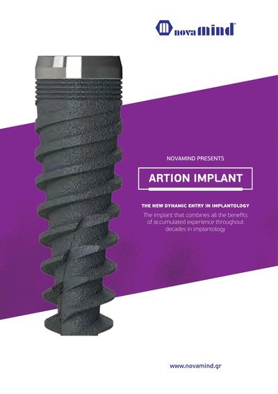 Novamind Dental Implants | SpotImplant