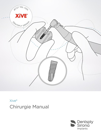 Dentsply Sirona XiVE TG (Friadent) Dental Implant | SpotImplant