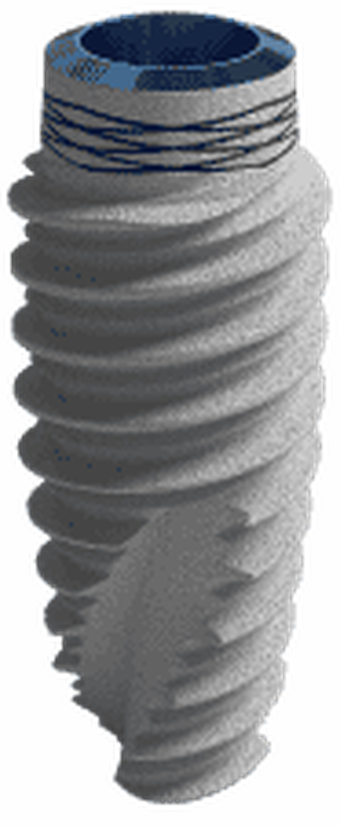AB Dental Devices Dental Implants | SpotImplant