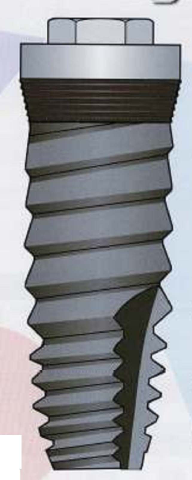 ACE Surgical Supply SDS Tapered RBM Dental Implant | SpotImplant