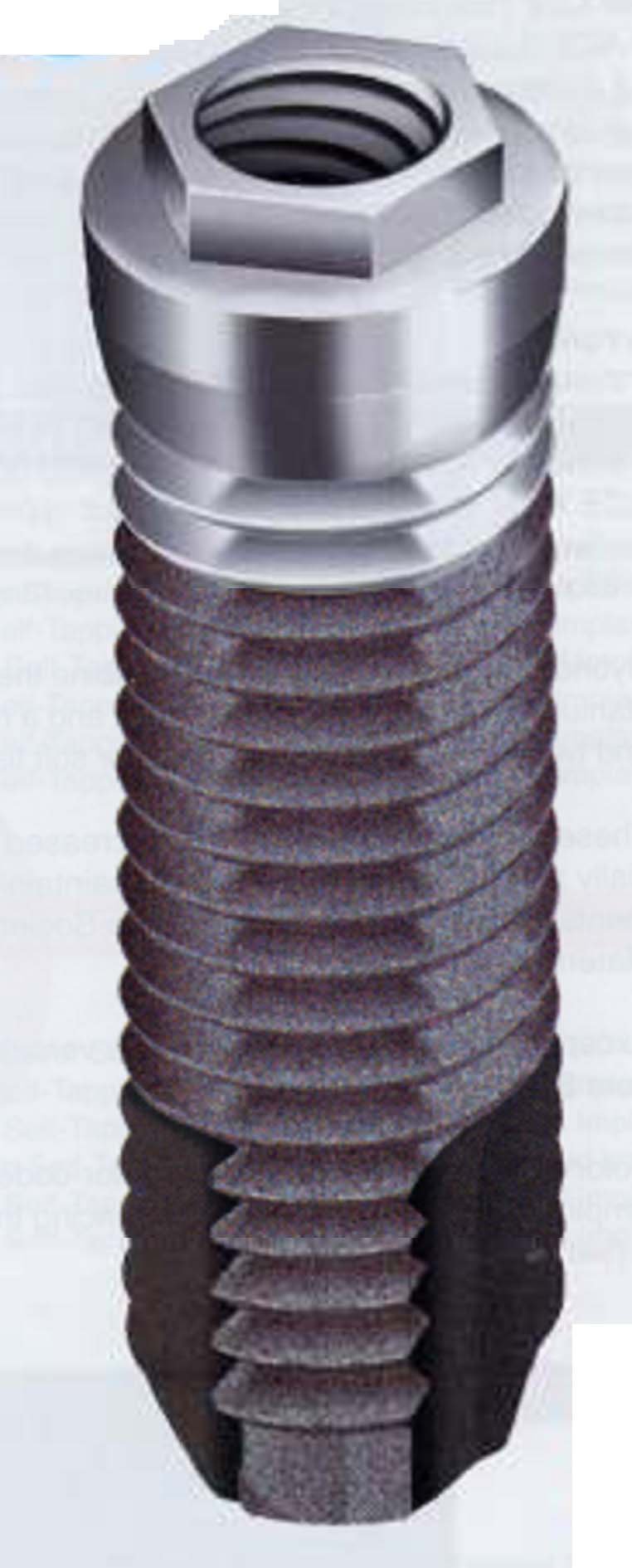 ACE Surgical Supply Standard RBM Implant dentaire | SpotImplant