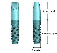 Advance Co. AQB Dental Implant | SpotImplant
