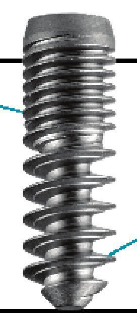 ARDS Implants Smart Dental Implant | SpotImplant