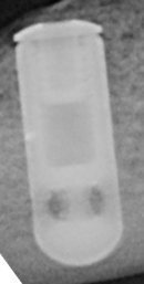 Sulzer Calcitek Integral Dental Implant | SpotImplant