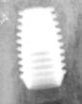Bicon Integra-CP Implante dental | SpotImplant