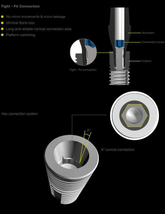 Biodenta Bone Level-BL Implant dentaire | SpotImplant