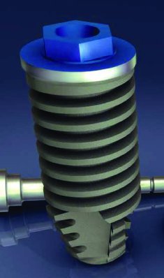 BioHorizons External Dental Implant | SpotImplant