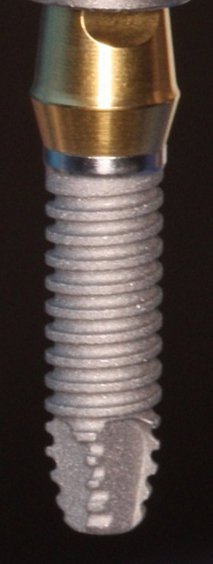 BioHorizons External (Maestro) Dental Implant | SpotImplant