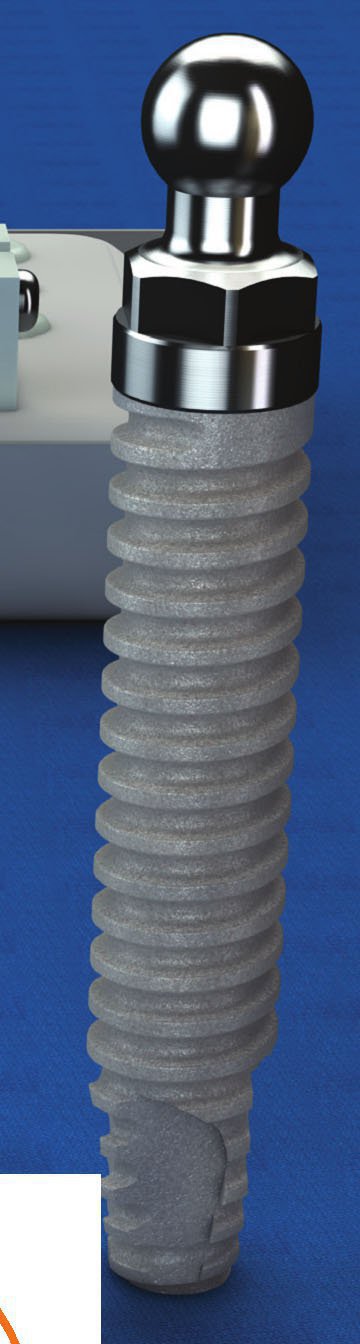 BioHorizons Overdenture Implant dentaire | SpotImplant