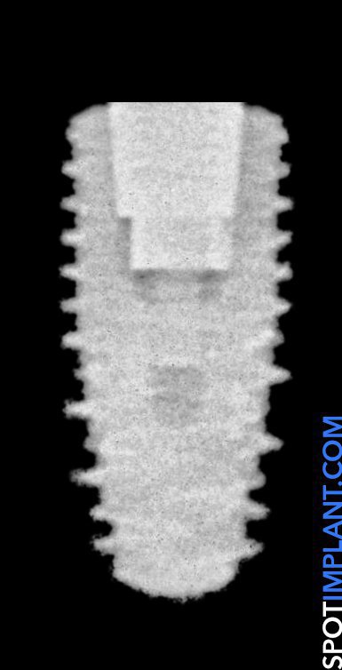 Biotech Dental Kontact Implant dentaire | SpotImplant