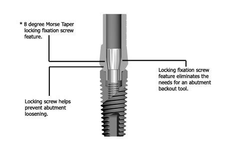 Blue Sky Bio Internal Hex Implante dental | SpotImplant
