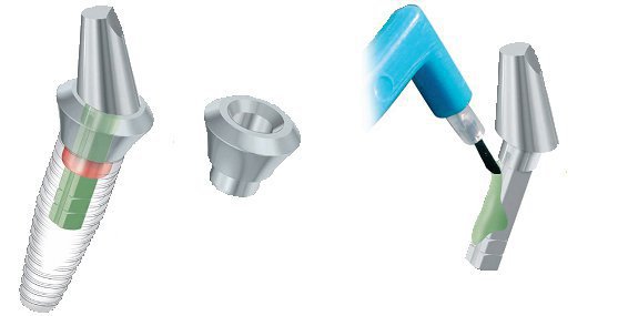 Bone System Bone System Dental Implant | SpotImplant
