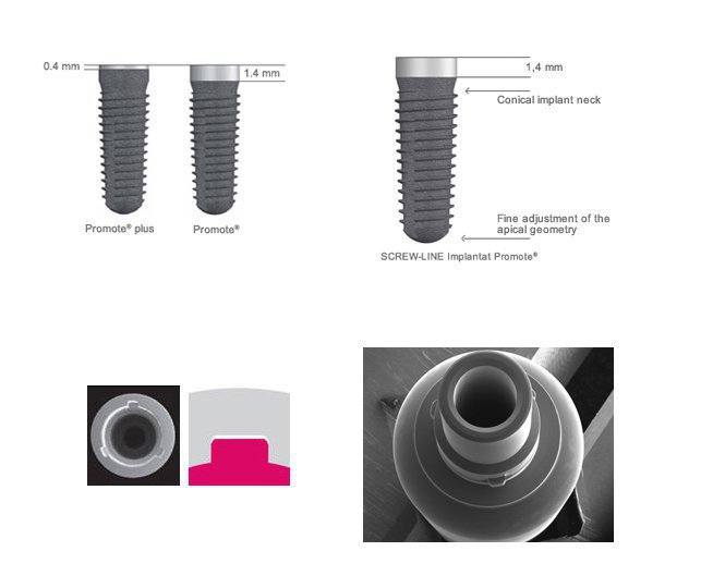 Camlog Screw-Line Implante dental | SpotImplant