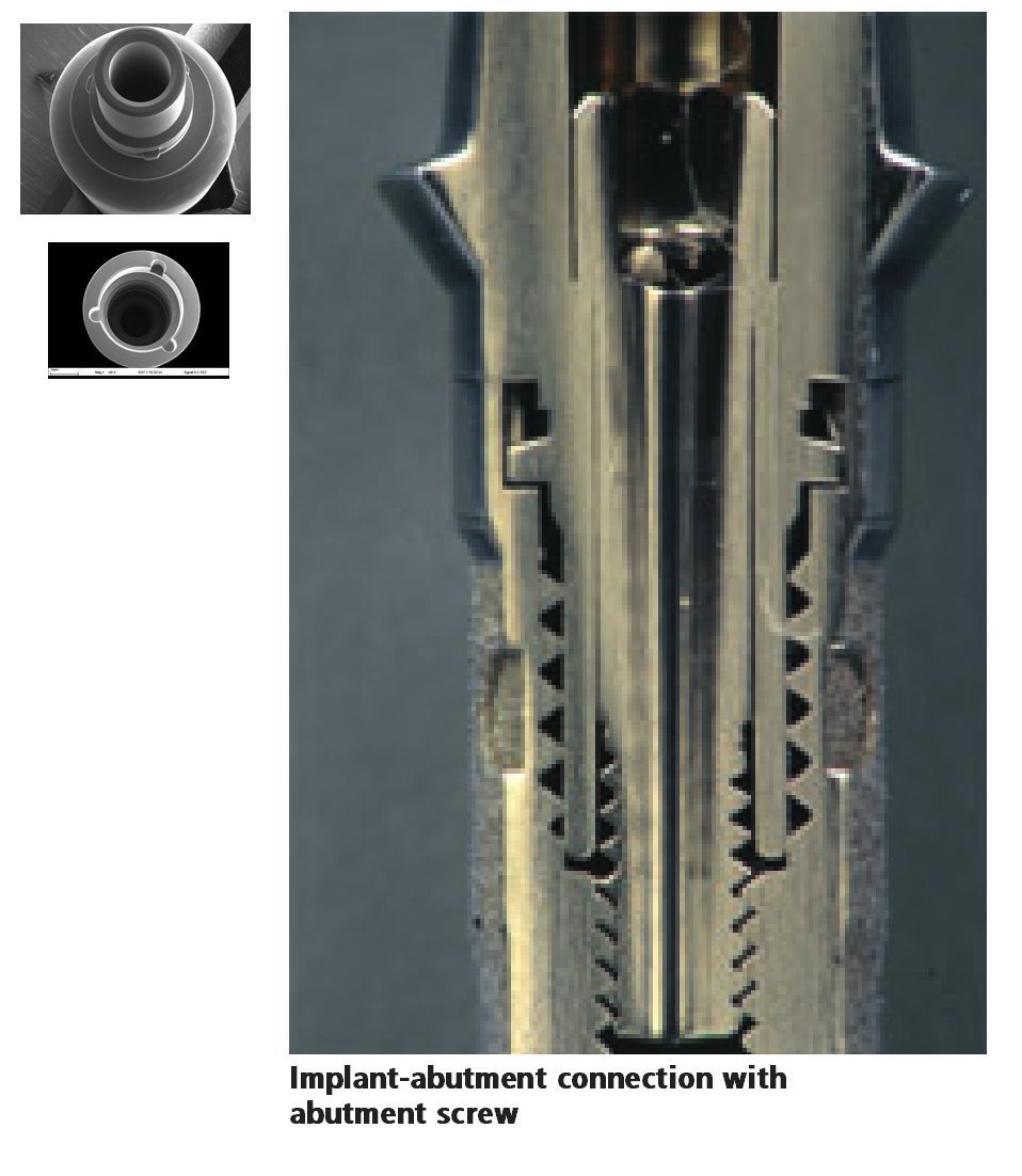Camlog Screw-Line Implante dental | SpotImplant
