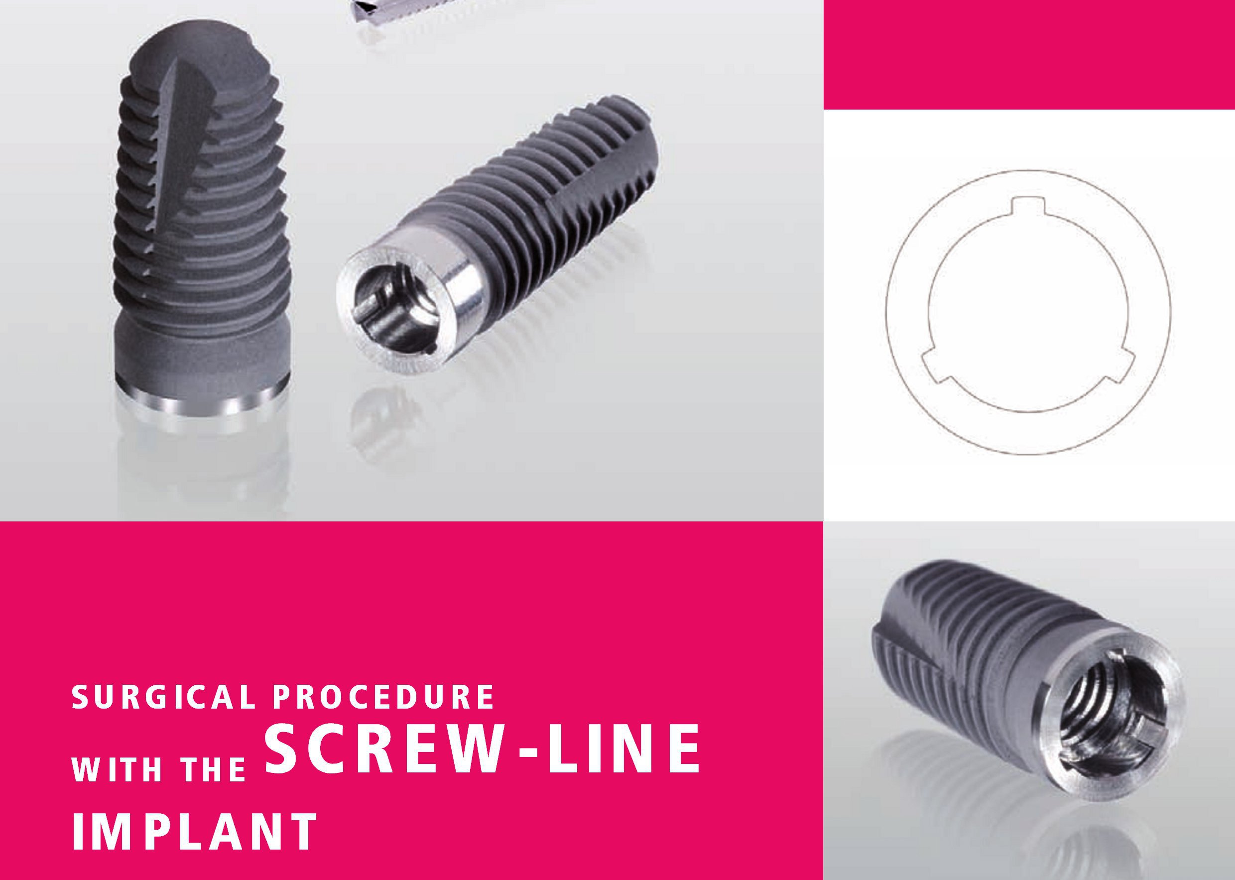 Camlog Screw-Line Implante dental | SpotImplant