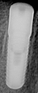 Camlog Screw-Line Implante dental | SpotImplant