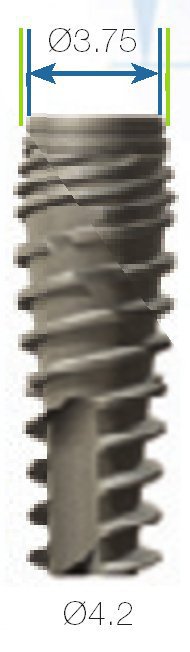 Cortex Dynamix Conical Dental Implant | SpotImplant