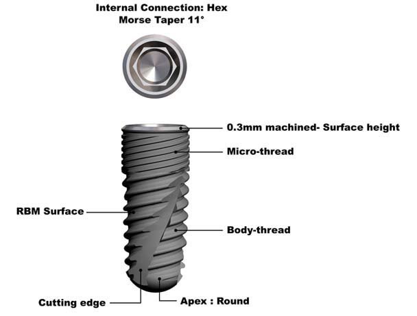 CSM Submerged 1 Dental Implant | SpotImplant