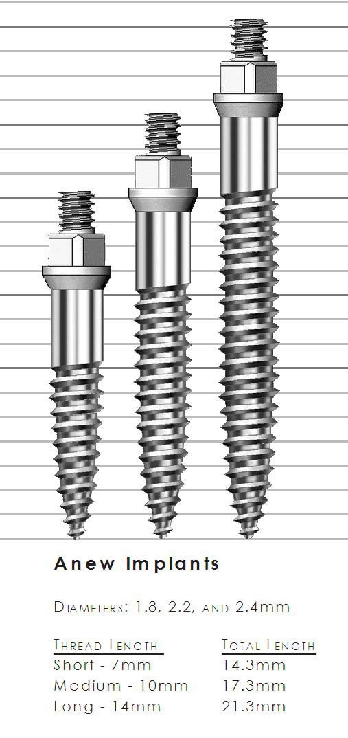 Dentatus Anew Dental Implant | SpotImplant
