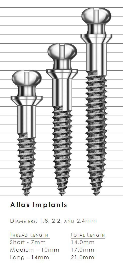 Dentatus Atlas Implant dentaire | SpotImplant