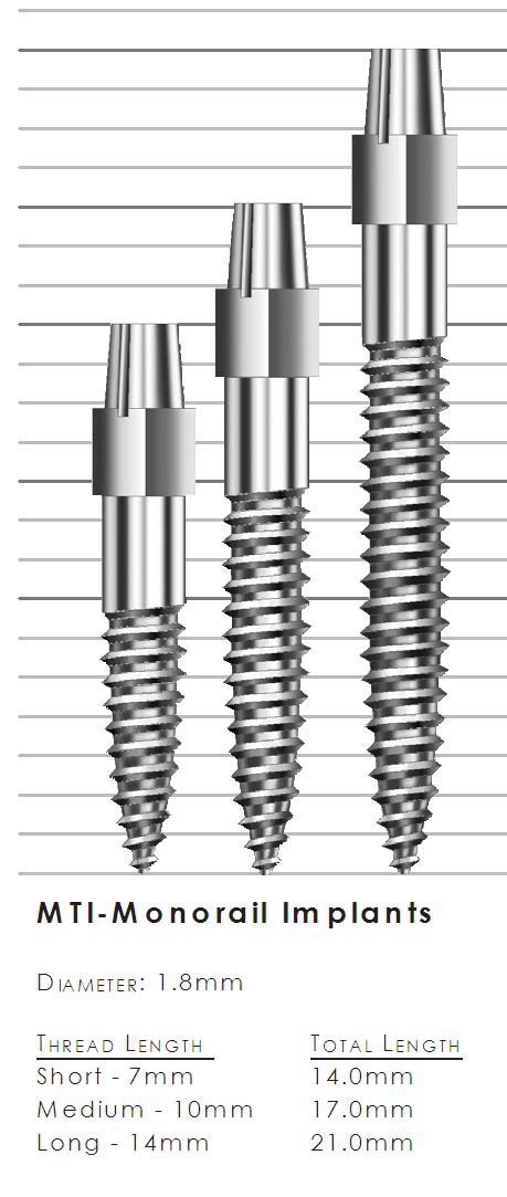 Dentatus MTI Dental Implant | SpotImplant