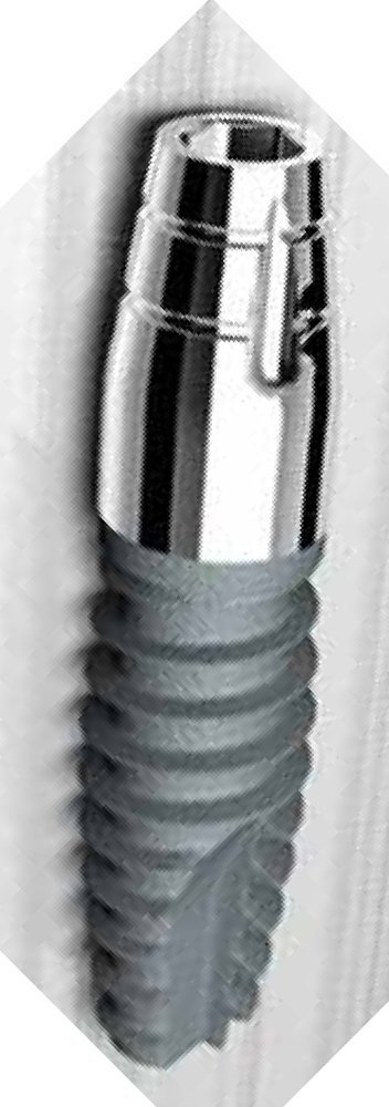 IDI Dental ONB Implant dentaire | SpotImplant