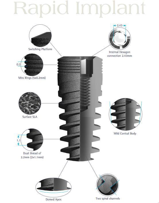 DENTIN Implants Technologies Rapid Dental Implant | SpotImplant