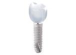 Dentsply Sirona XiVE S (Friadent) Implant dentaire | SpotImplant