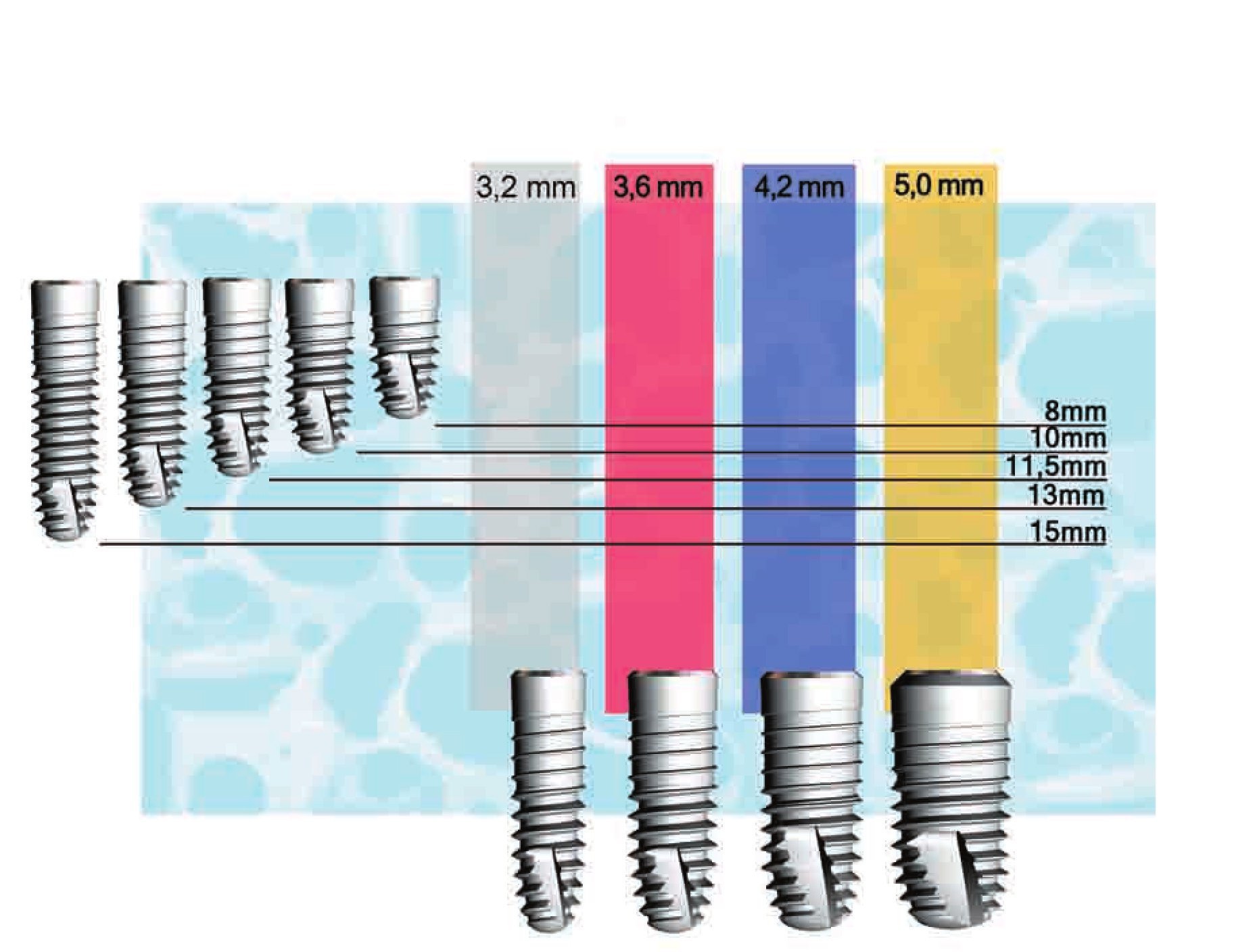 Dyna Dental Helix DC Dental Implant | SpotImplant
