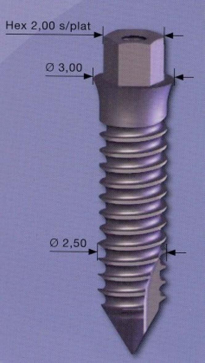 Easy System Implant Mini Implant Implant dentaire | SpotImplant