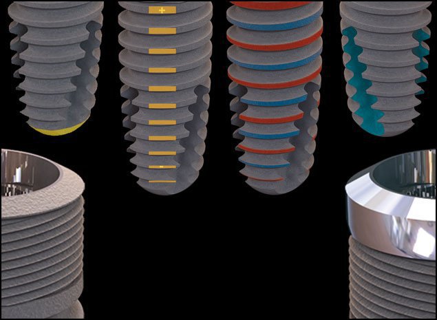 Eckermann Triplo Dental Implant | SpotImplant