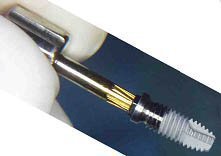 Elite Medica Fastite Dental Implant | SpotImplant