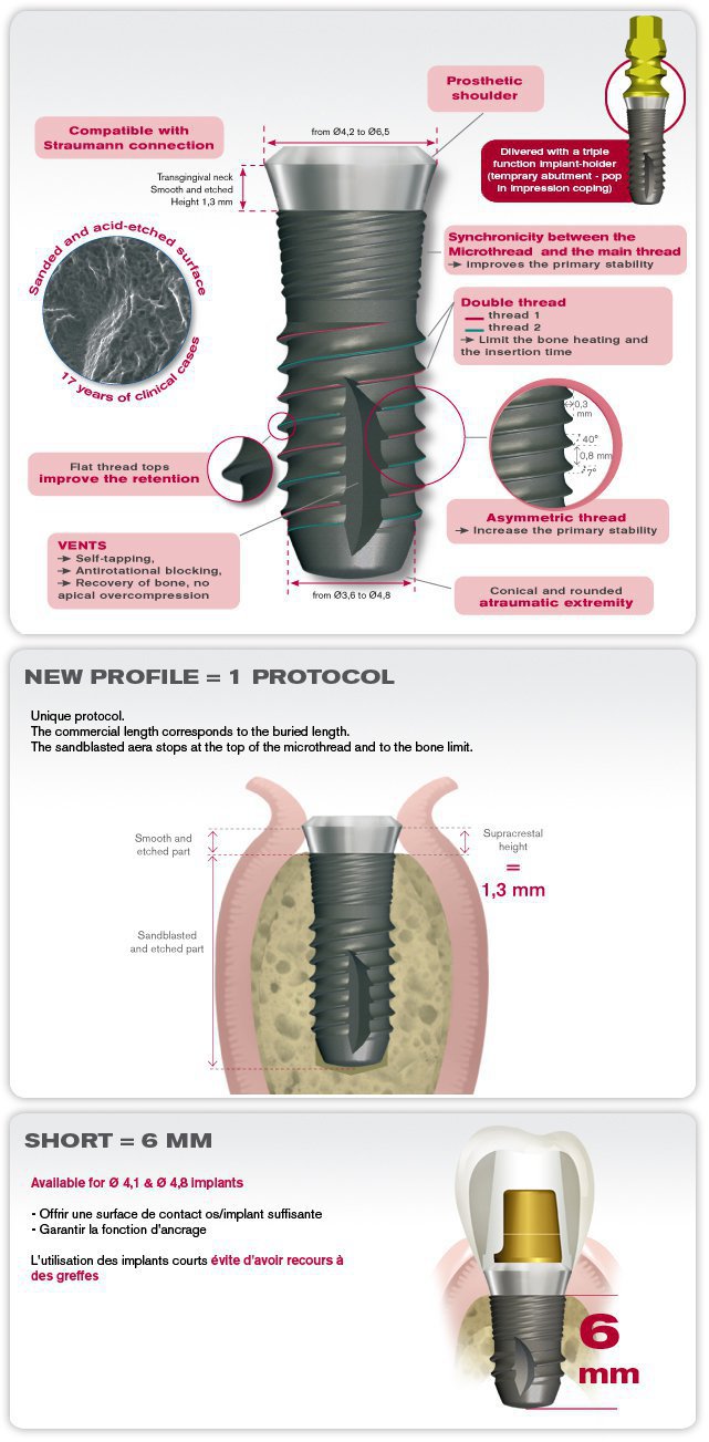 ETK (Euroteknika) Aesthetica+2 Implant dentaire | SpotImplant