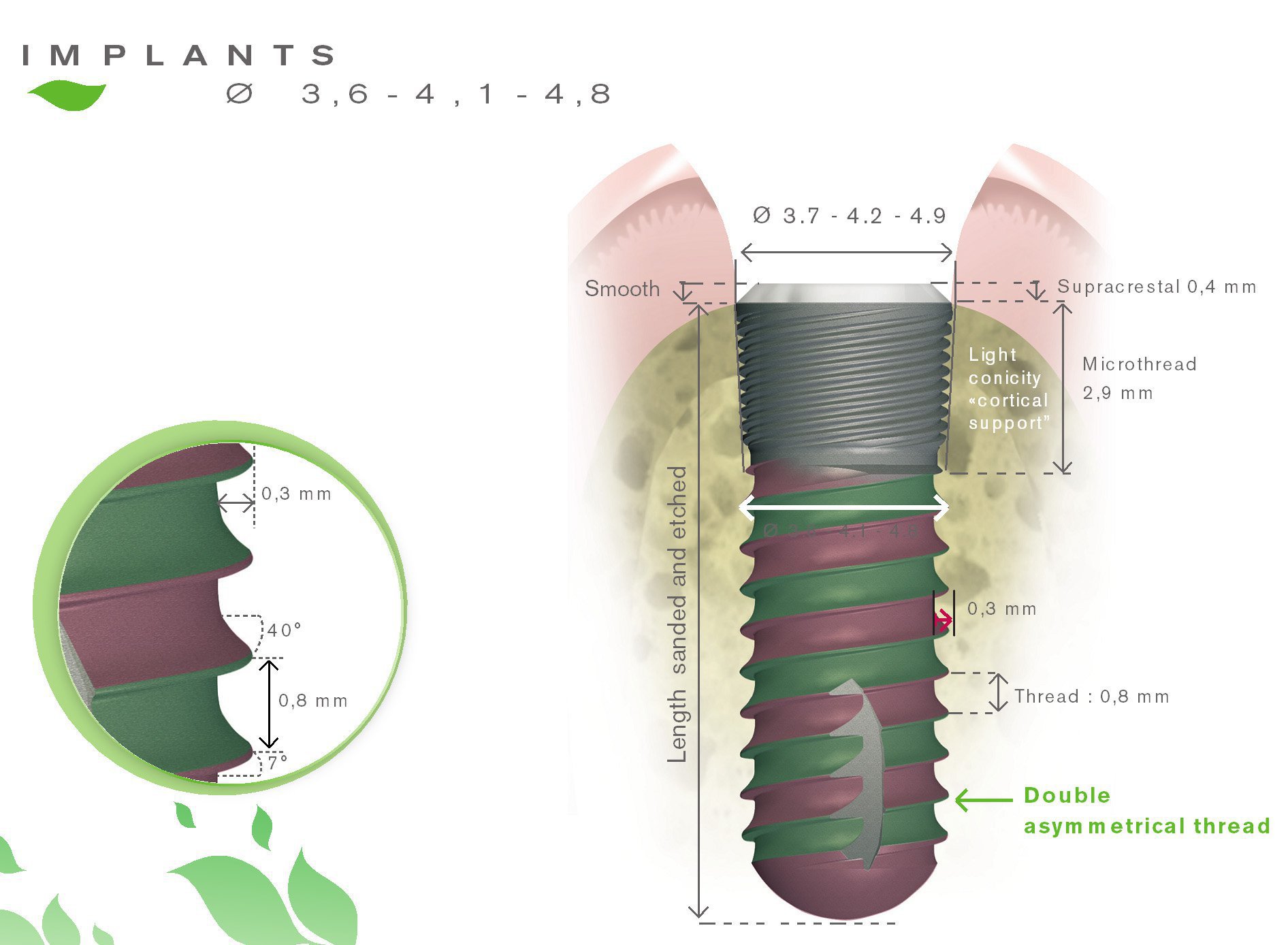 ETK (Euroteknika) Natea+ Implant dentaire | SpotImplant