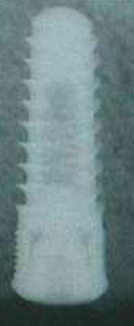 ETK (Euroteknika) Naturall+ Dental Implant | SpotImplant