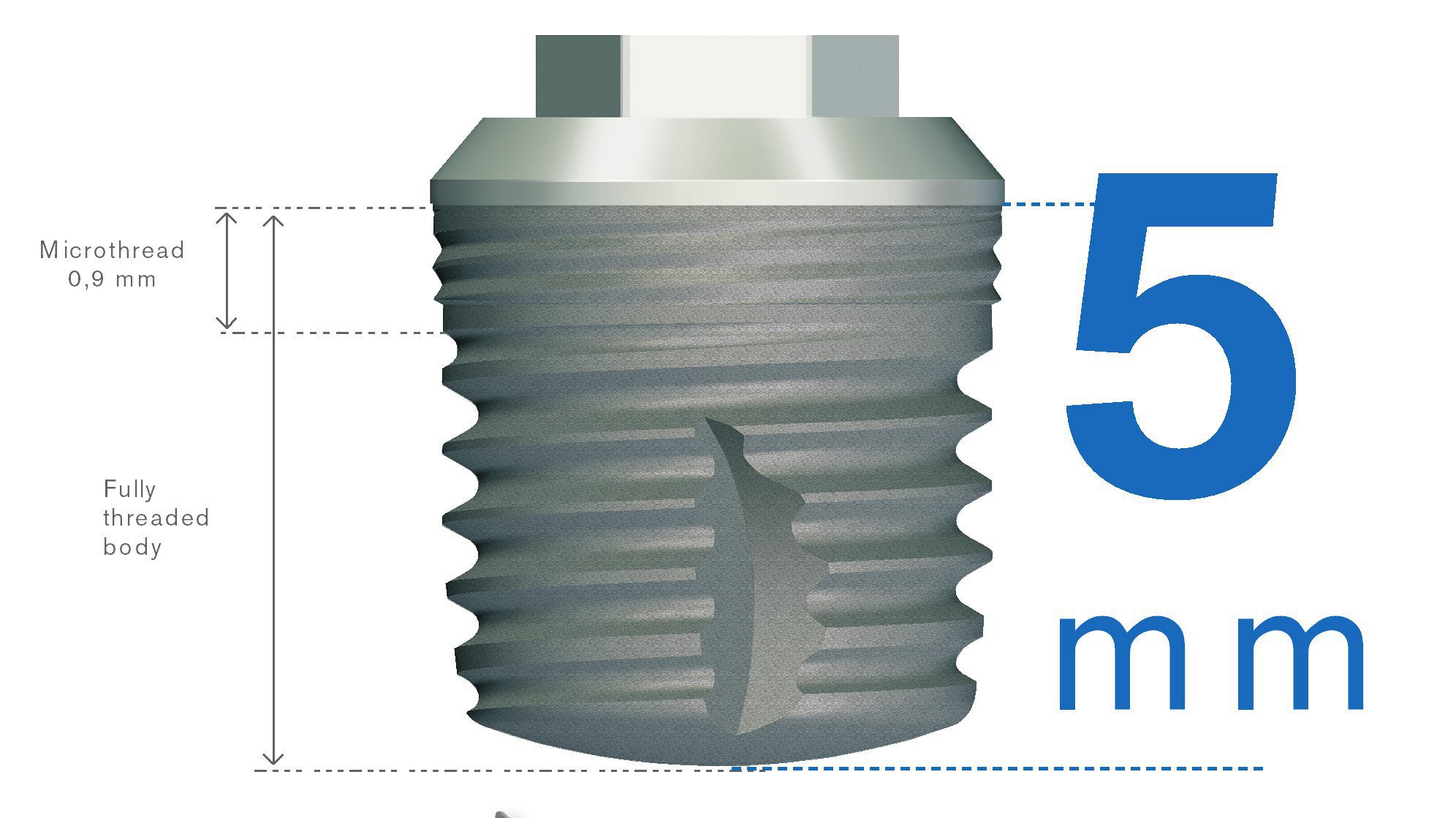 ETK (Euroteknika) Universal+ (Wide) Dental Implant | SpotImplant