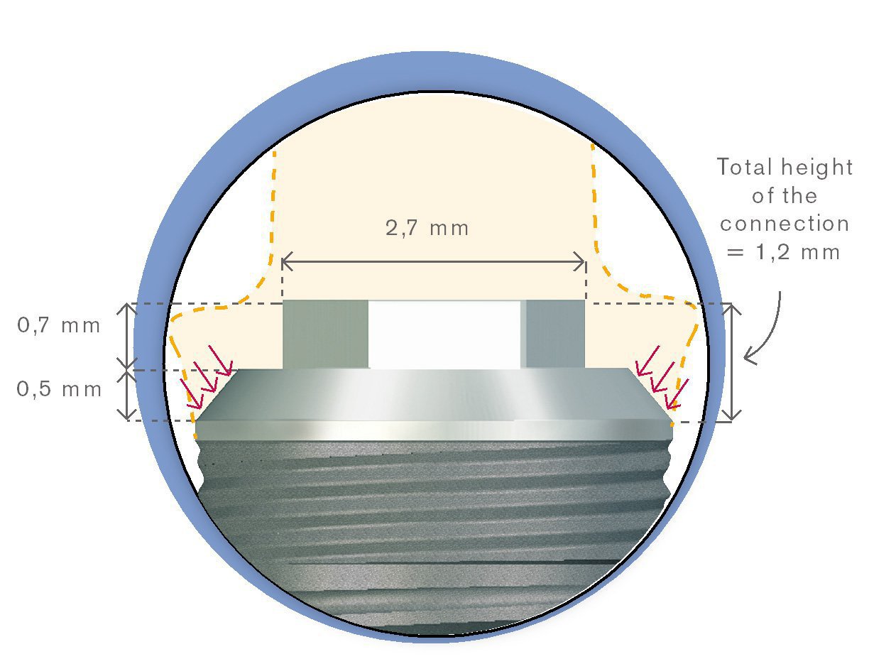 ETK (Euroteknika) Universal+ (Wide) Dental Implant | SpotImplant