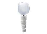 Friadent Frialit-2 Synchro Implante dental | SpotImplant