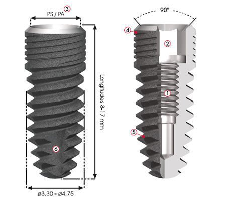 GMI (Global Medical Implants) Frontier Implante dental | SpotImplant